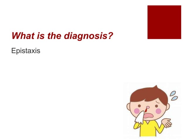 Epistaxis- ENT.pptx | Ear, Nose and Throat Conditions | Diseases and Conditions