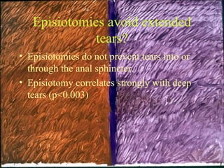 Epi overview | PPT