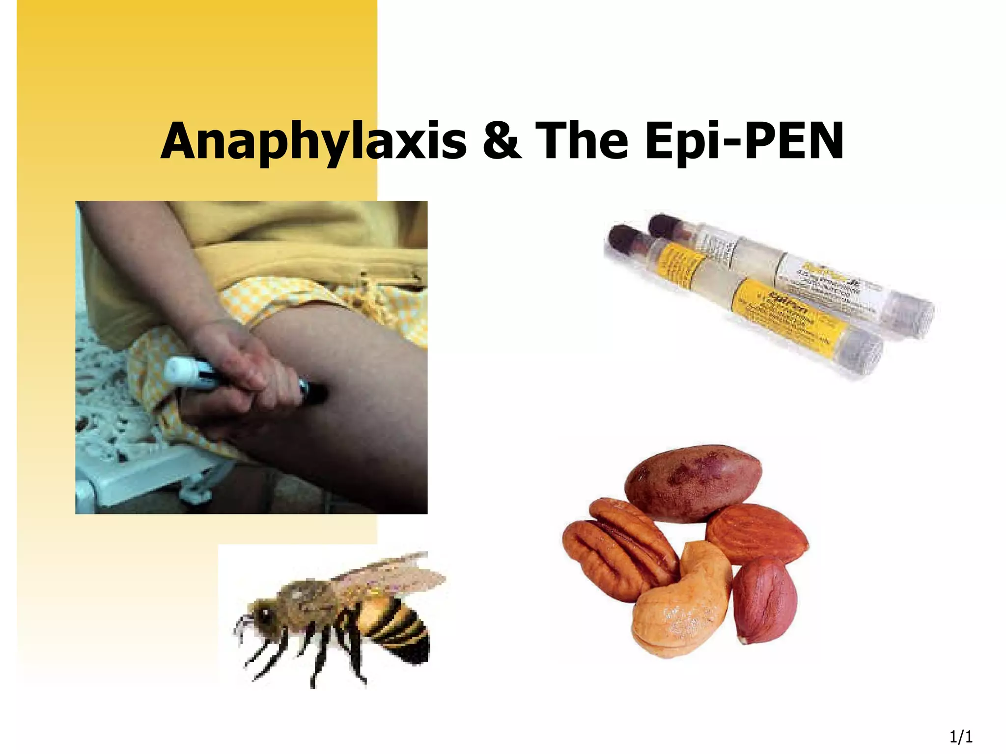 Epi pen presentation | PPT
