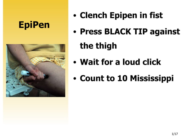 Epi pen presentation | PPT | Allergies | Diseases and Conditions