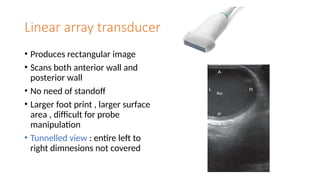 epiaortic echocardiography in cardiac surgery | PPTX