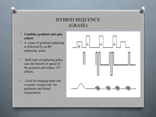 Echo Planer Imaging- By Saquib khurshid / ppt | PPTX