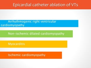 Epicardial VT | PPTX