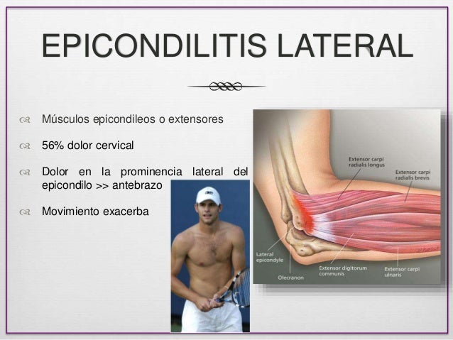 Epicondilitis medial y lateral - Tenosinovitis Quervain - Traumatolo…