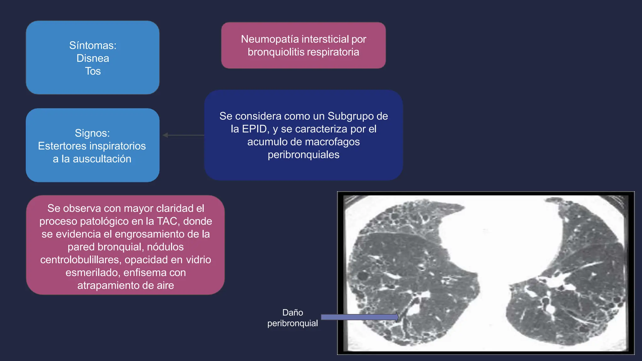 ENFERMEDAD PULMONAR INTERSTICIAL DIFUSA. PPT | PPT