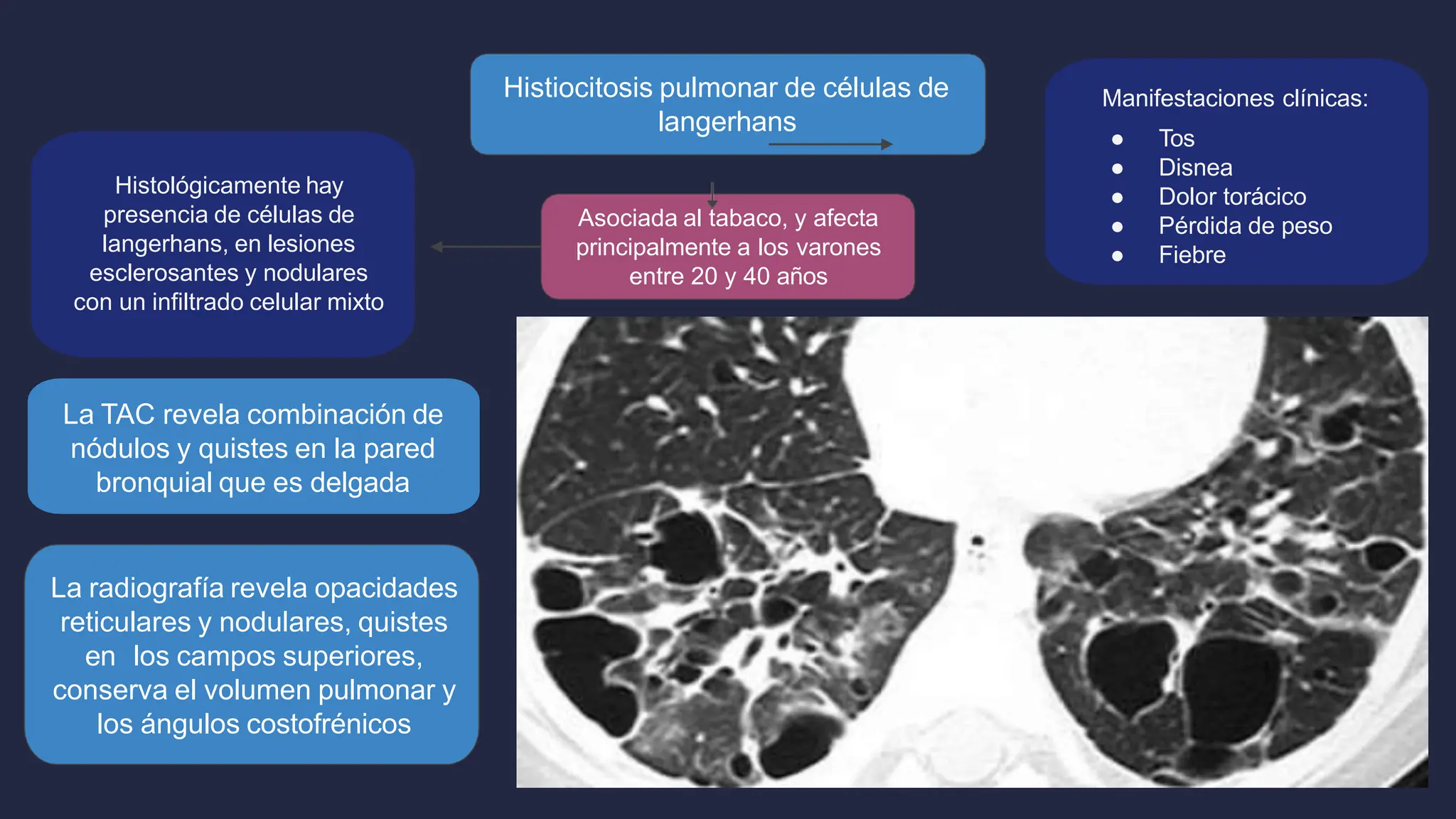 ENFERMEDAD PULMONAR INTERSTICIAL DIFUSA. PPT | PPT