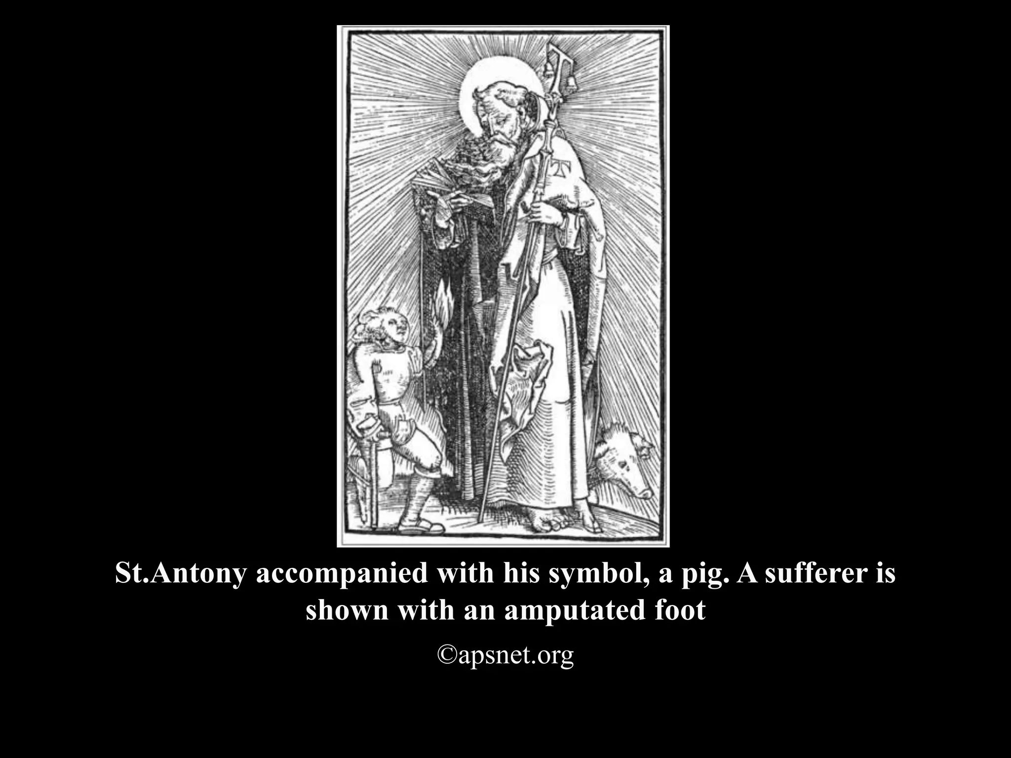 Epidemics of plant diseases in the world | PPTX