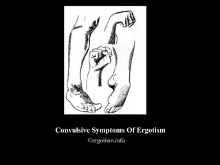 Epidemics of plant diseases in the world | PPTX