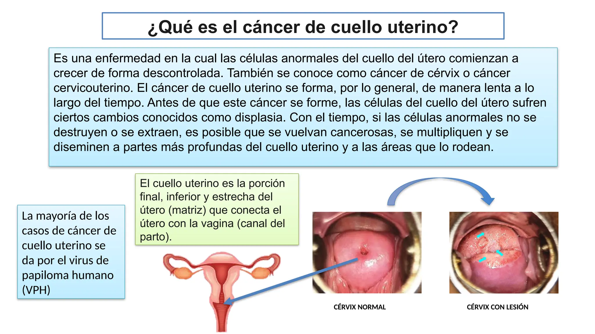 epidemiologia del cáncer de cervix o cancer de cuello uterino pptx | PPTX