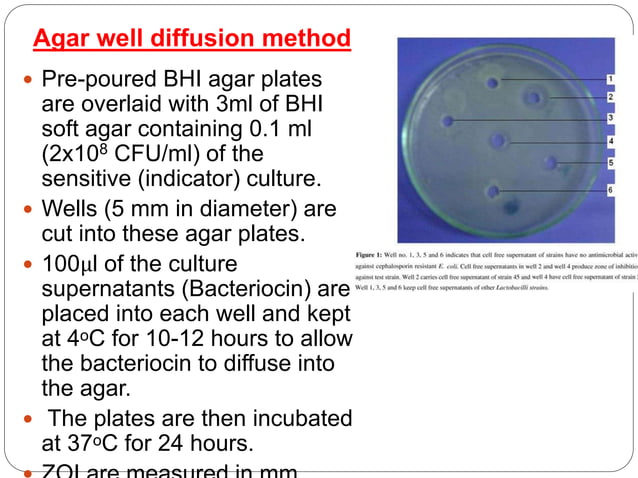 Epidemiological marker (serotyping and bacteriocin typing) | PPTX | Infectious Diseases ...