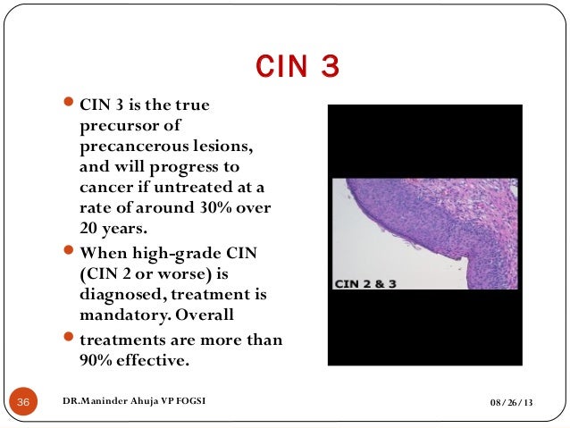 Epidemiology and carcinogenesis of premalignant lesions of cervix