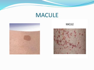 EPIDEMIOLOGY – COMMUNICABLE DISEASE.pptx