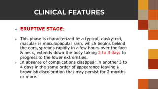 Epidemiology & Control Measures of Measles.pptx | Infectious Diseases ...