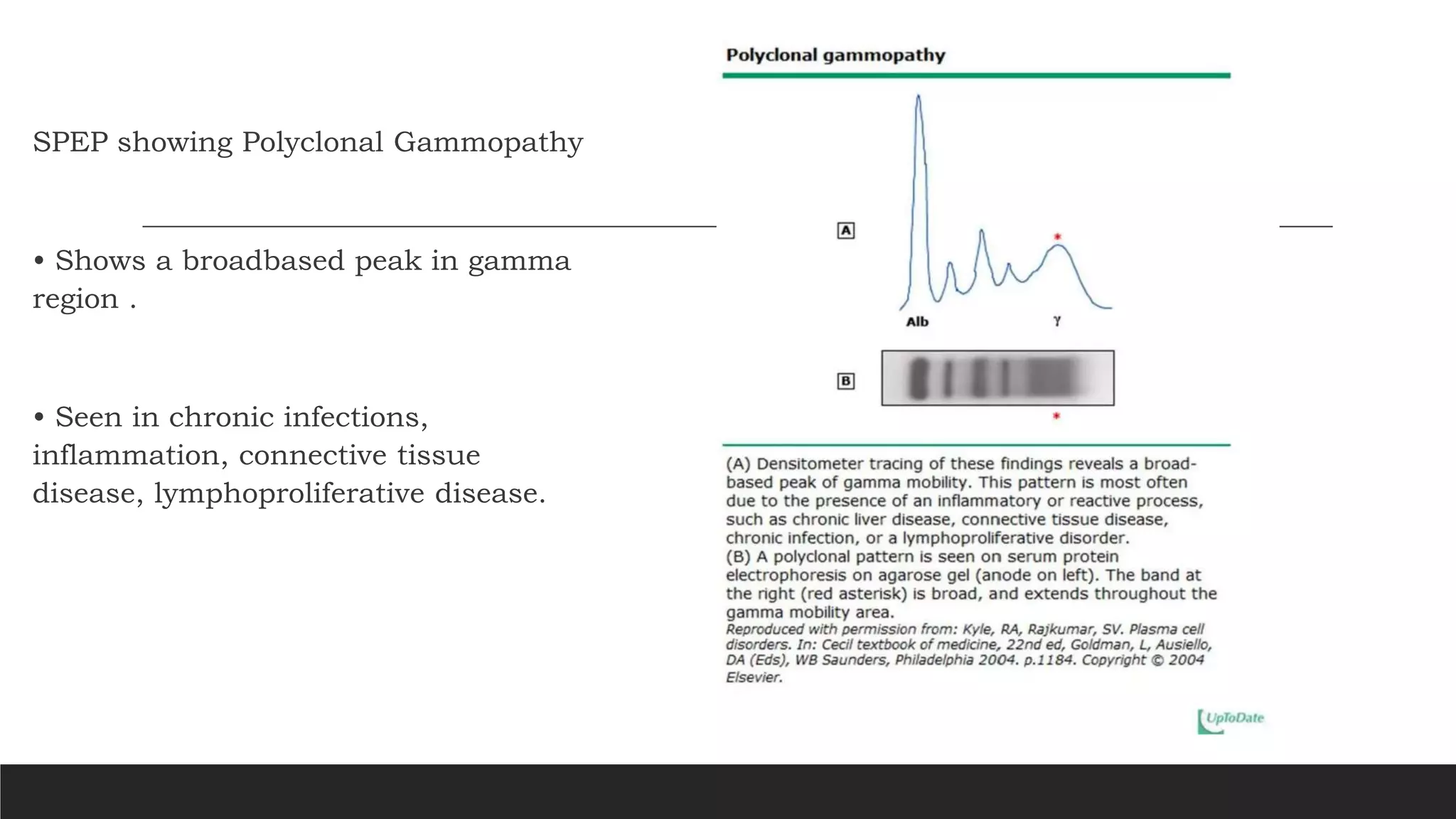 Epidemiology, Etiopathogenesis, Pathology, Staging of Plasma Cell ...