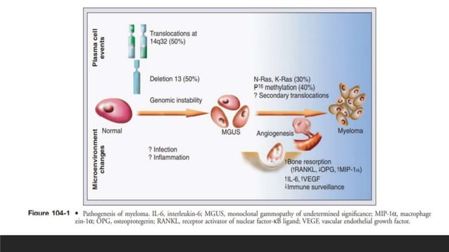 Epidemiology, Etiopathogenesis, Pathology, Staging of Plasma Cell ...