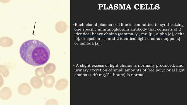 Epidemiology, Etiopathogenesis, Pathology, Staging of Plasma Cell ...