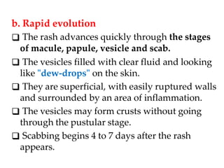 Epidemiology of chickenpox.pptx. .. | PPT