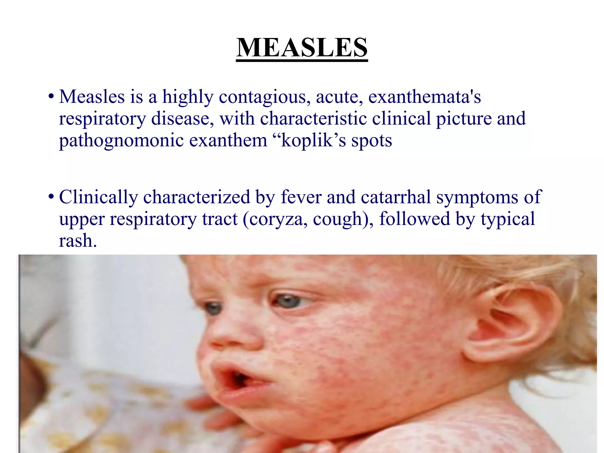 epidemiology of common infectious diseases-resp,git,arthropod.pptx