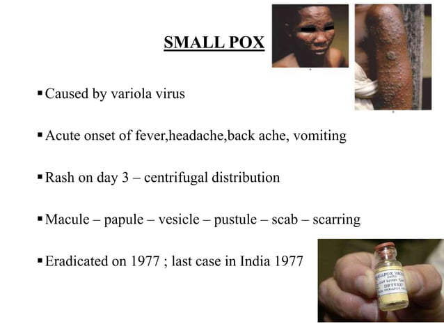 epidemiology of common infectious diseases-resp,git,arthropod.pptx