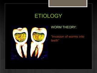 Epidemiology of dental caries | PPTX