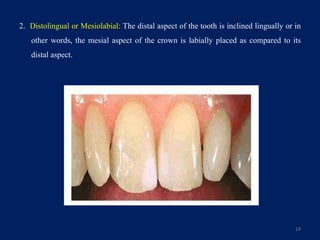 Epidemiology of malocclusion | PPTX