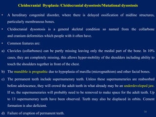 Epidemiology of malocclusion | PPTX