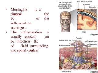 Epidemiology of MENINGOCOCCAL MENINGITIS.pptx