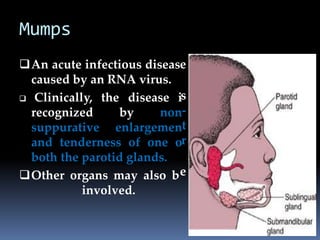 Epidemiology of mumps.pptx. . | PPT