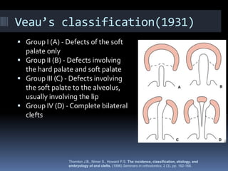Epidemiology of Orofacial Clefts | PPTX