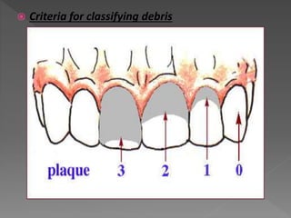 Epidemiology of perio diseases | PPT