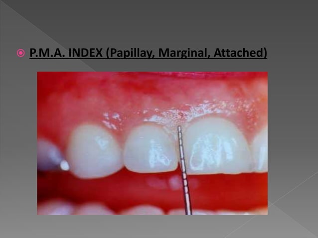 Epidemiology of perio diseases | PPT
