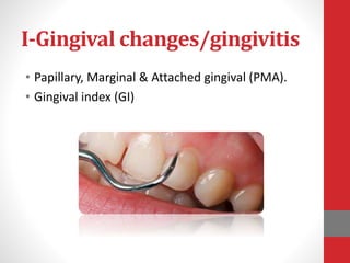 Epidemiology of periodontal disease ( main stream ) | PPT