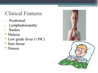 Epidemiology on Rubella.pptx........................... | PPTX