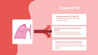 Four Levels of Prevention in Tuberculosis Management | PPT