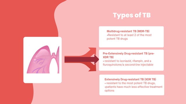 Four Levels of Prevention in Tuberculosis Management | PPT