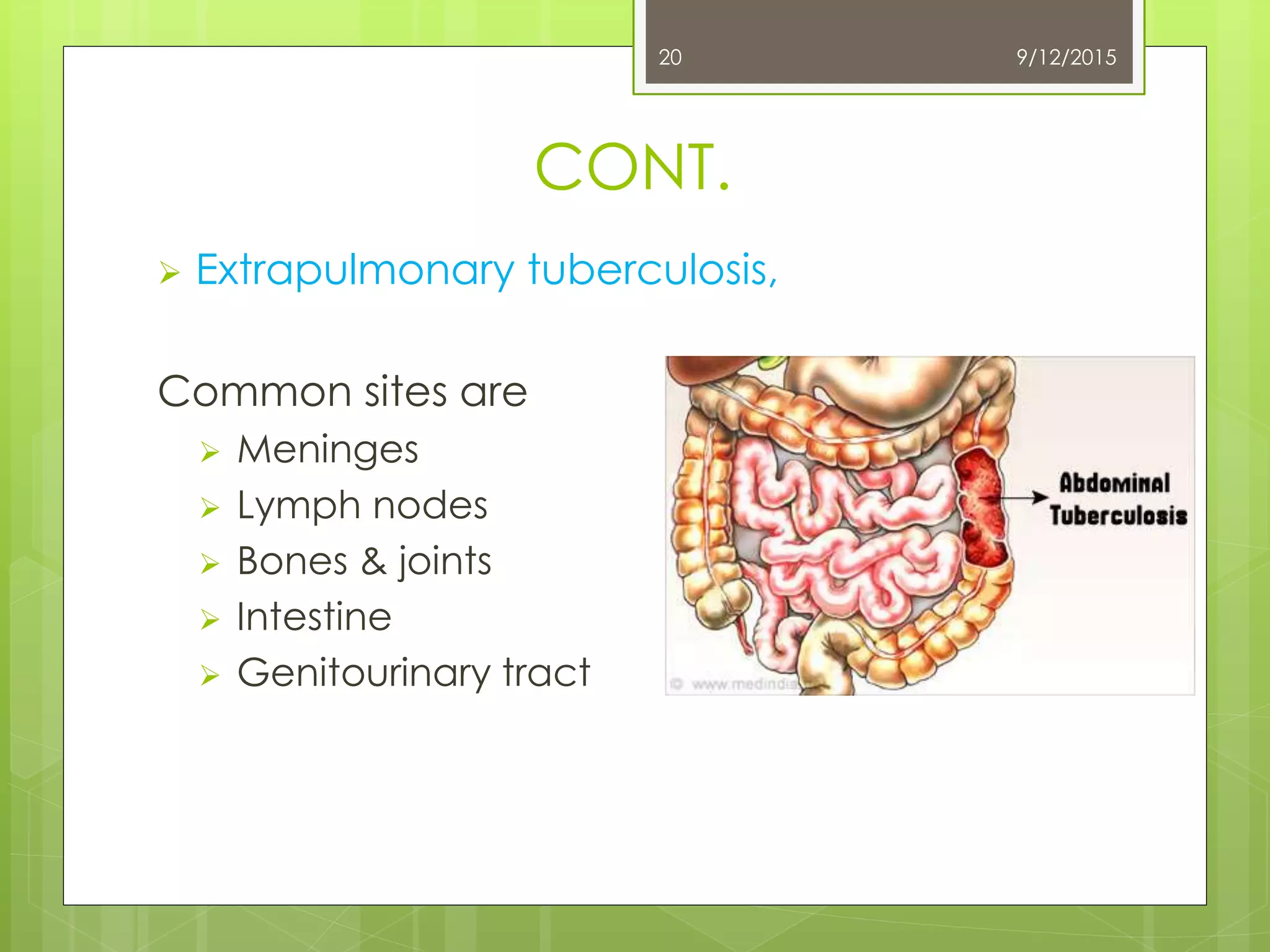 Epidemiology & prevention of tuberculosis | PPTX