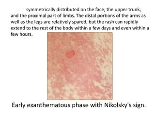 Epidermal necrolysis | PPTX