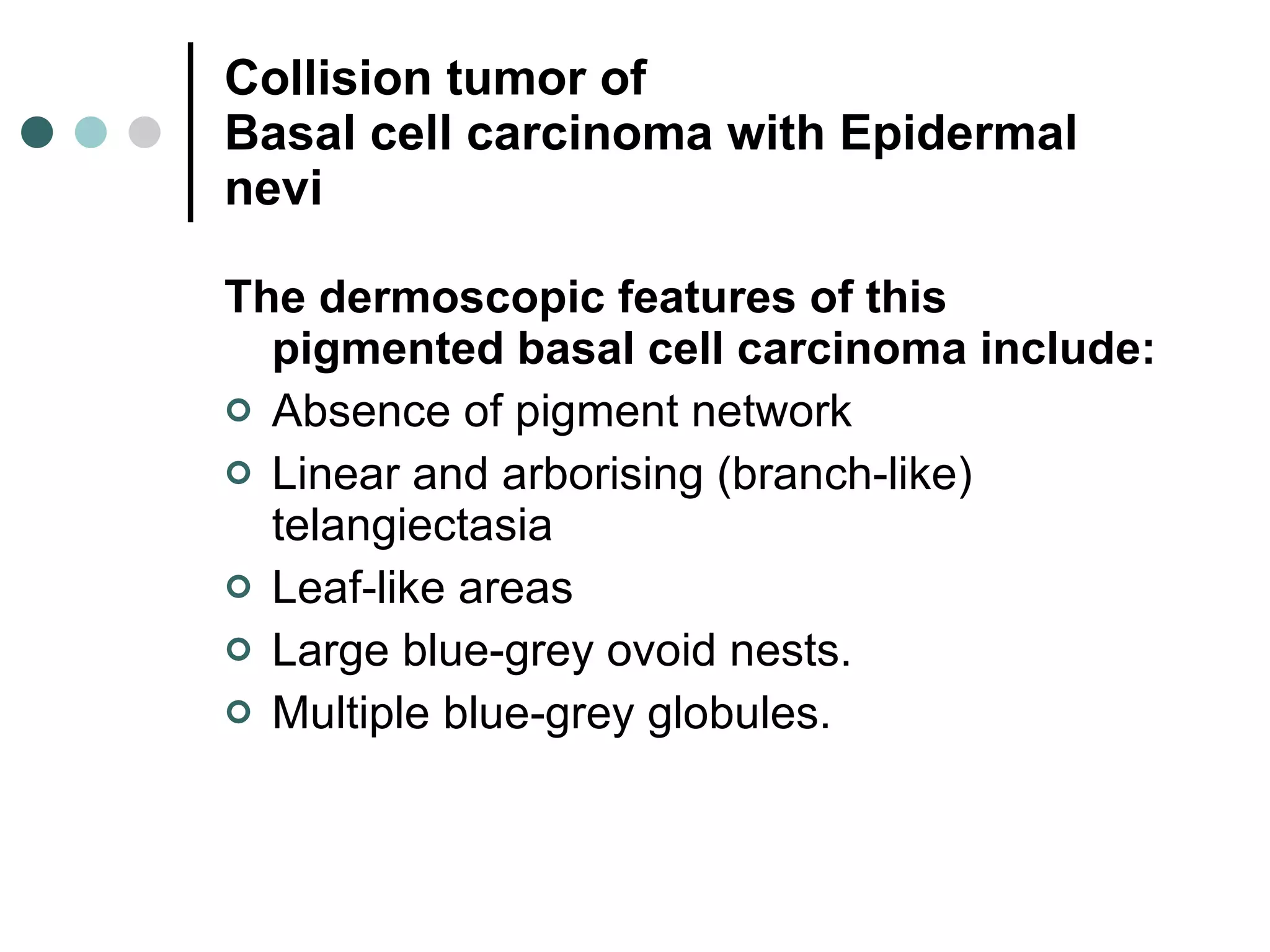 Epidermal nevi and basal cell carcinoma | PPT