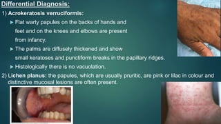 Epidermodysplasia verruciformis and HPV in Immunocompromised | PPT
