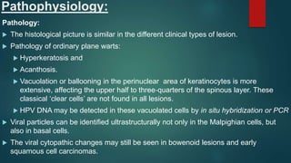 Epidermodysplasia verruciformis and HPV in Immunocompromised | PPTX