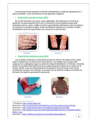 Epidermolisis Bullosa (Ampollosa) | PDF