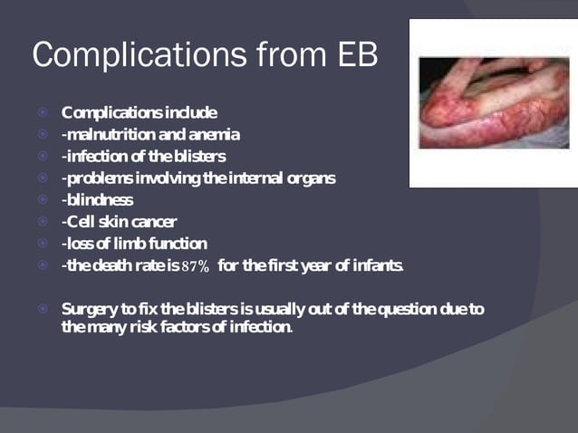 Epidermolysis Bullosa | PPT | Skin and Dermatology | Diseases and ...