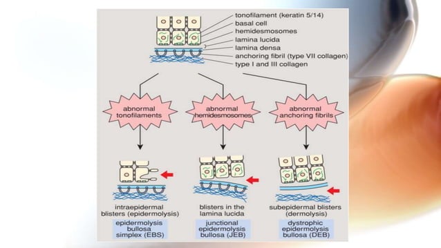 Epidermolysis bullosa | PPTX | Skin and Dermatology | Diseases and ...