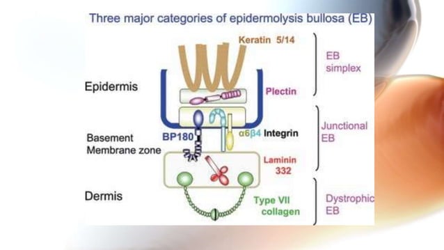 Epidermolysis bullosa | PPTX | Skin and Dermatology | Diseases and ...
