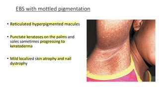 epidermolysis bullosa 2.pdf for derma resident | PDF