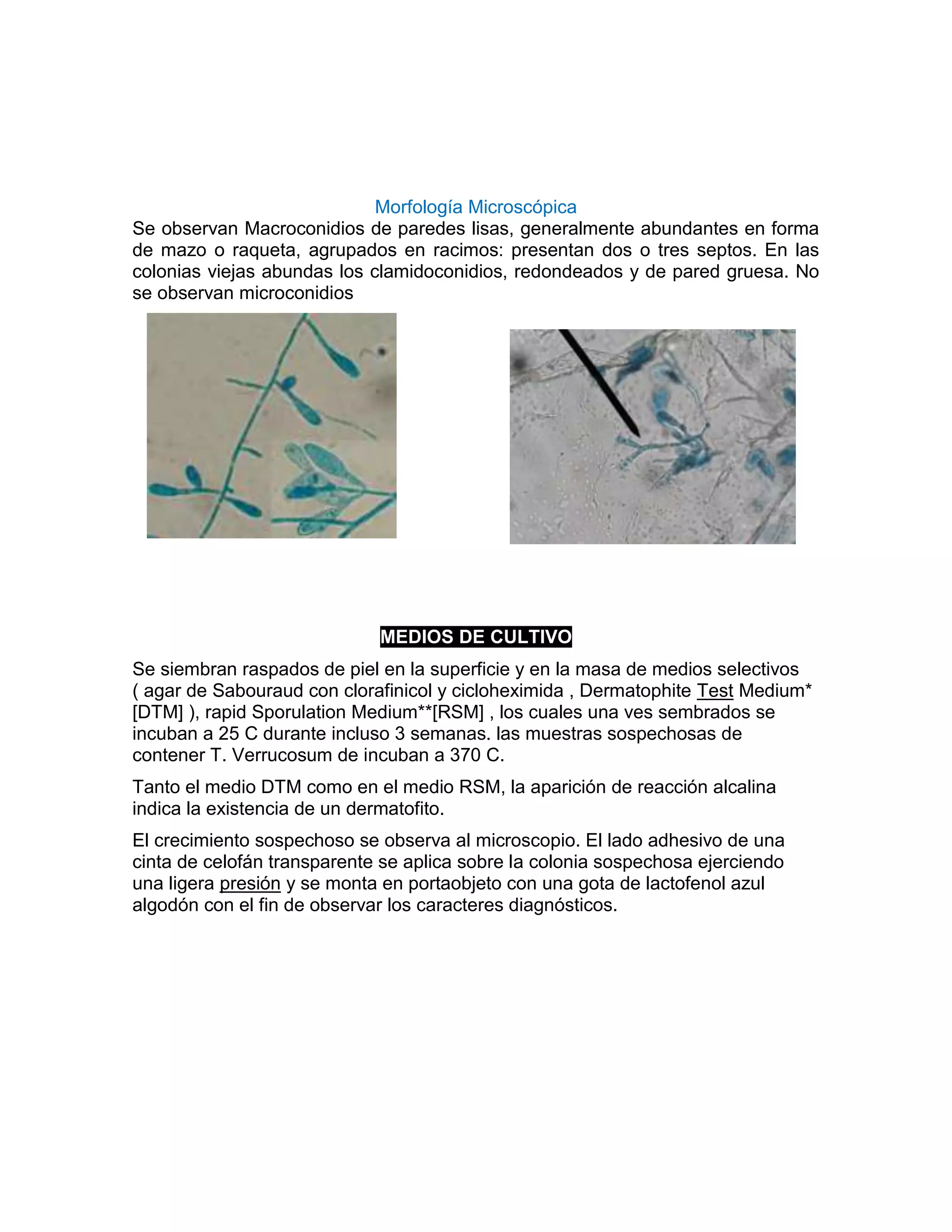 Epidermophyton floccosum | DOCX