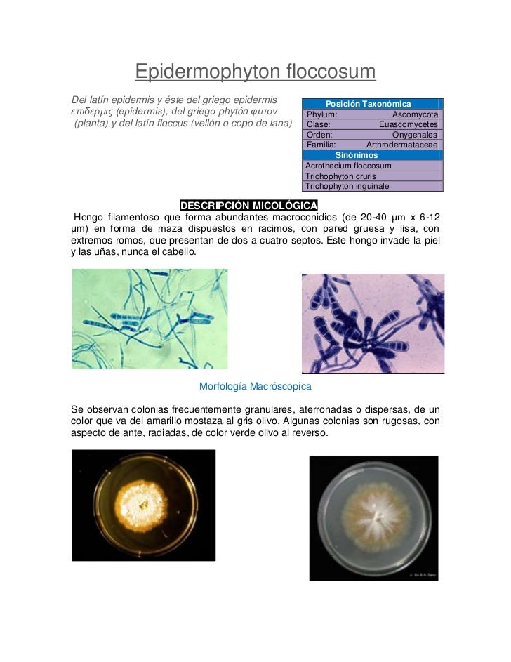 Epidermophyton floccosum
