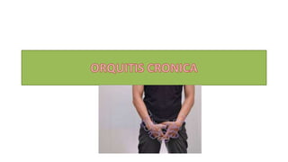 Epididimitis y-orquitis-aguda-y-cronica (1) | PPTX