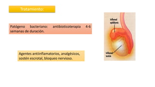 Epididimitis y-orquitis-aguda-y-cronica (1) | PPTX