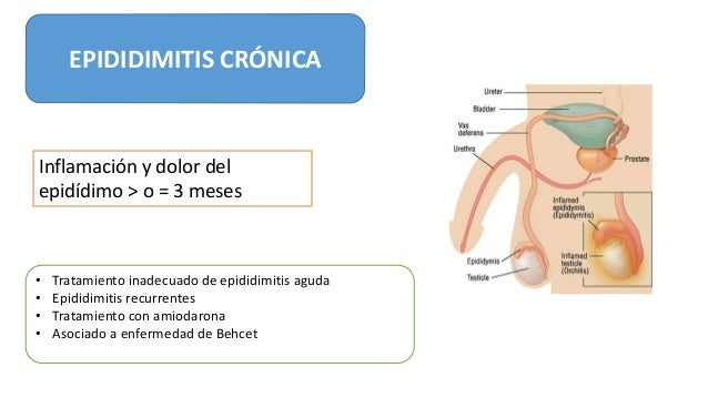 Epididimitis Y Orquitis Aguda Y Cronica 1